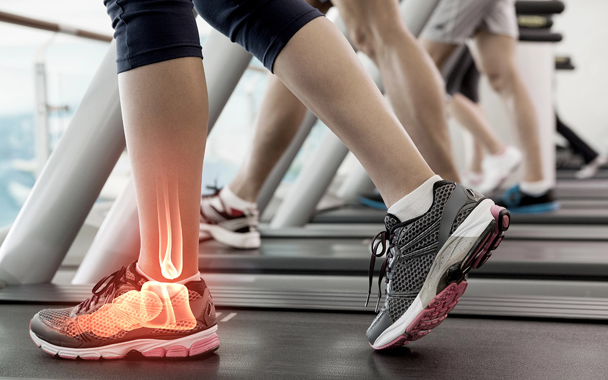 Ankle Agility: Understanding Sprains and How to Bounce Back - Corona ...